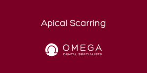 What Is Apical Scarring? | Omega Dental Houston TX