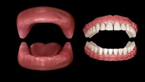 What Is A Dental Flipper? | Omega Dental Houston TX