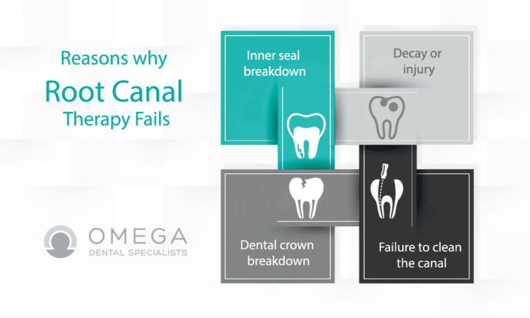 Failed Root Canal Symptoms & Treatment Options | Omega Dental