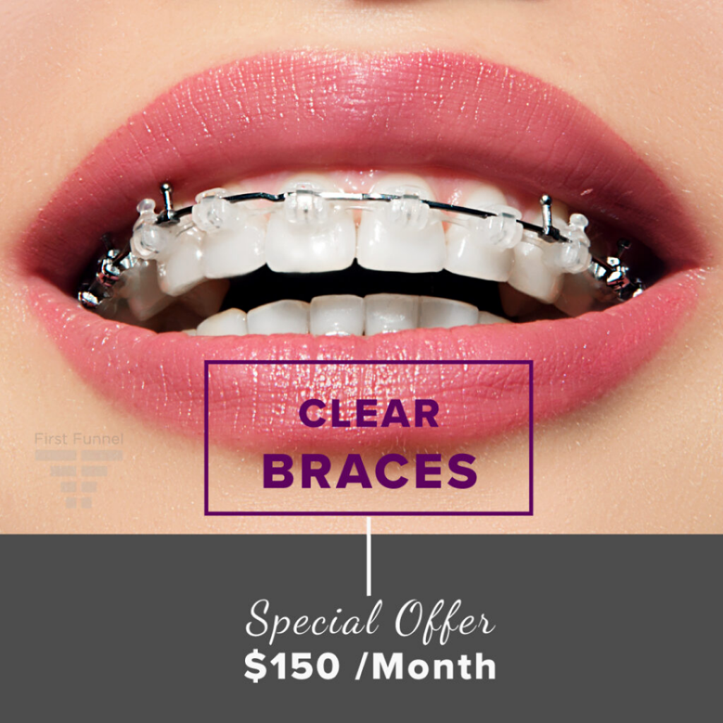 Special Offers for Your Smile | Omega Dental Houston